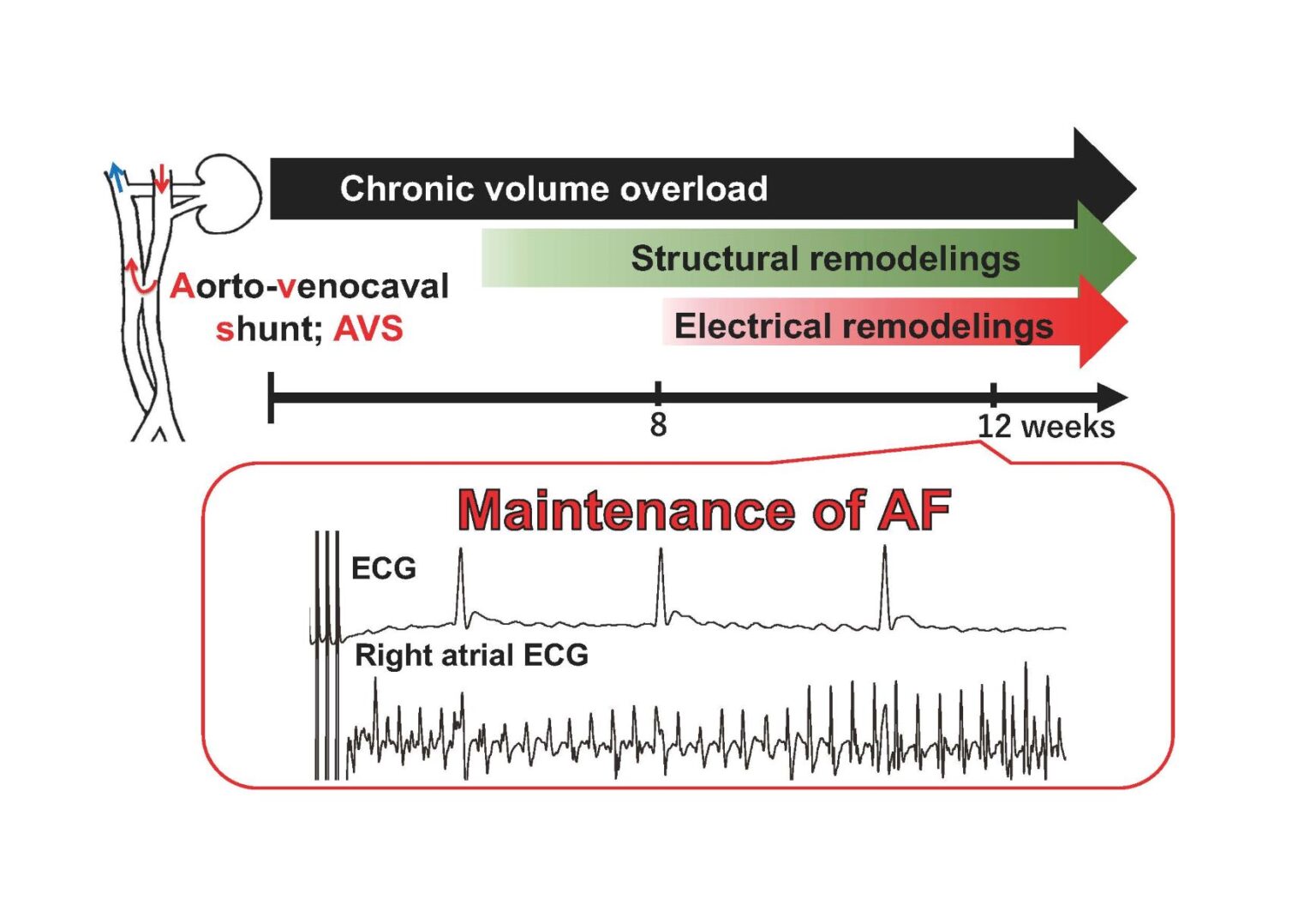 Acquisition process of pro-arrhythmic substrate responsible for atrial ...