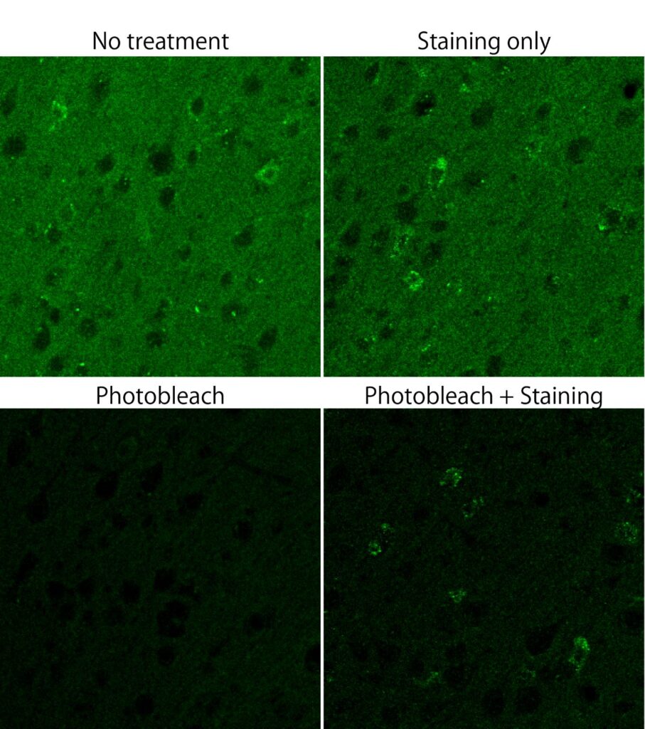 Development of TiYO for autofluorescence quenching, tissue staining and ...