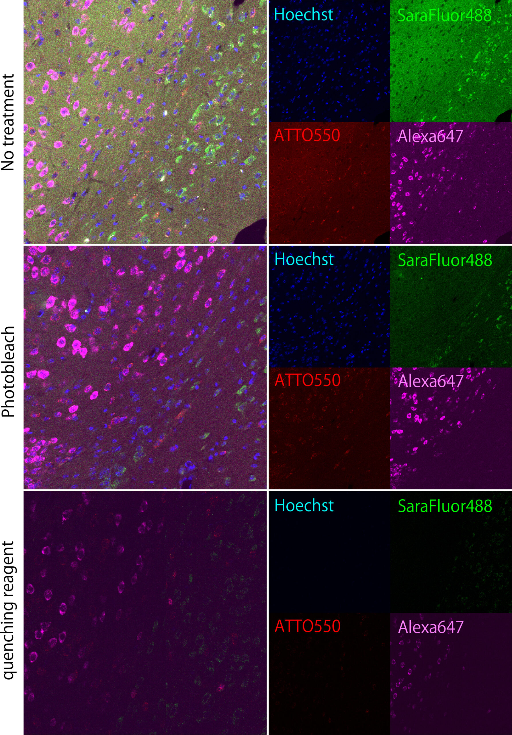 Development of TiYO for autofluorescence quenching, tissue staining and ...