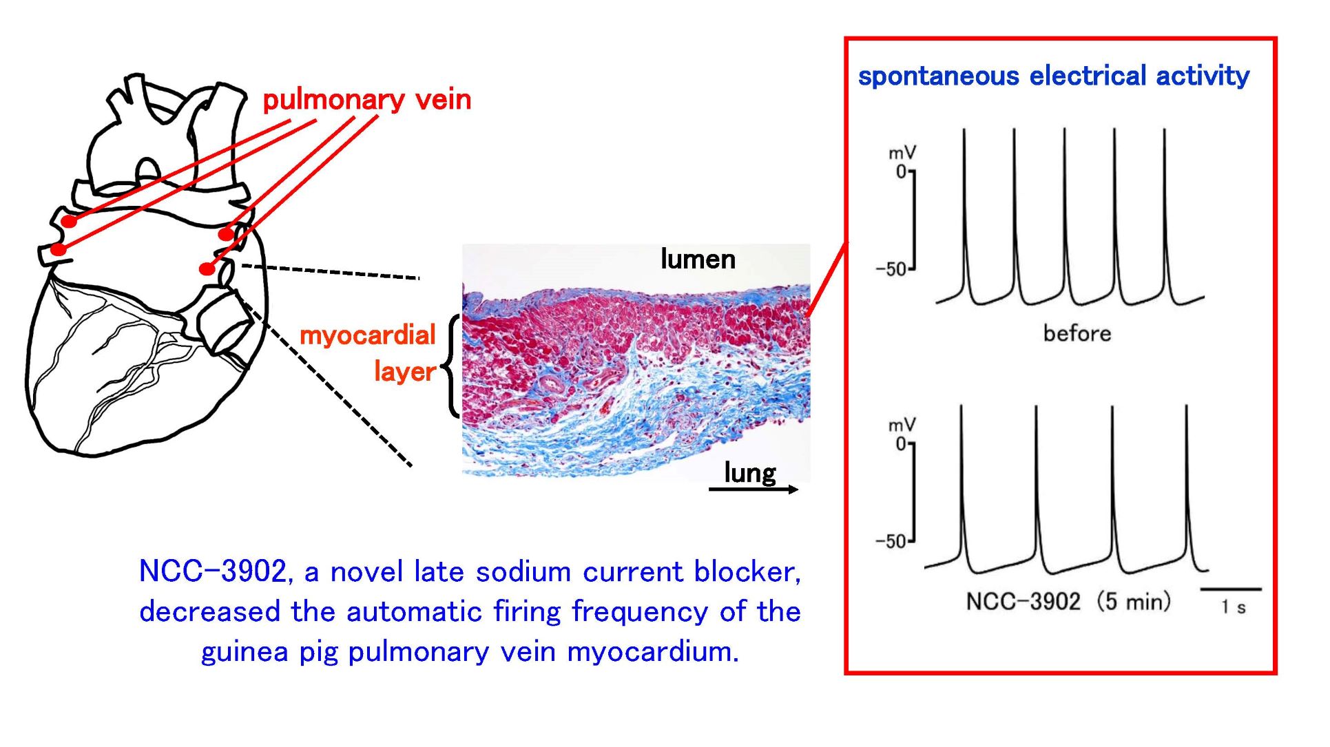 NCC-3902 shows therapeutic potential against atrial fibrillation by ...
