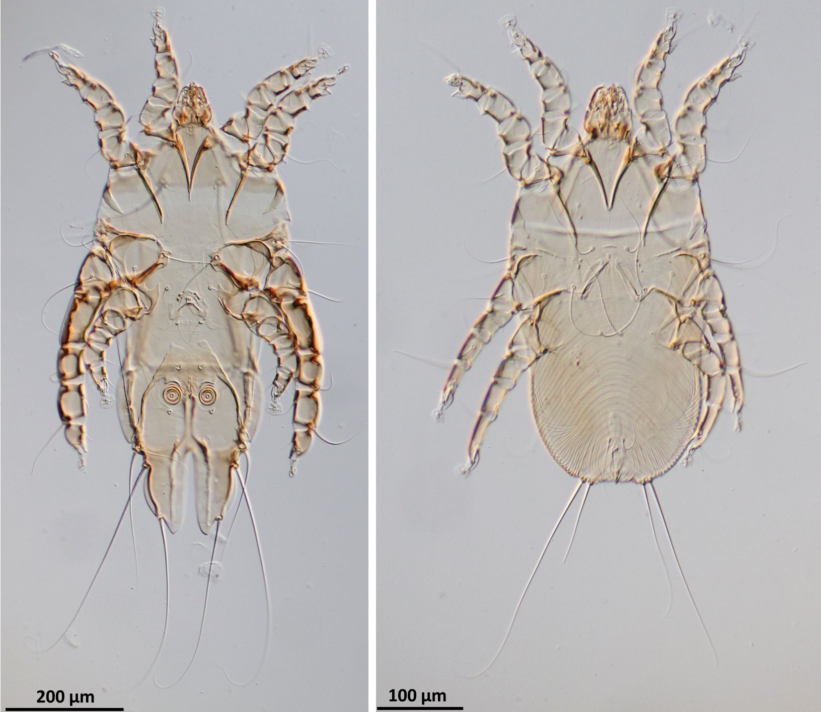 Discovery of a New Species of Feather Mite from the Endangered Okinawa ...